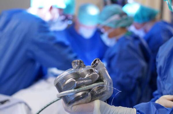 New generation of artificial hearts promises lifeline to patients ...